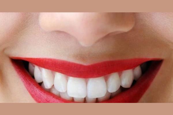 Can you guess the celebrity from their smile?