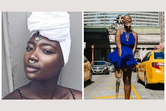 This Amputee Was Told She Had 3 Weeks To Live But She Grew Up Into An