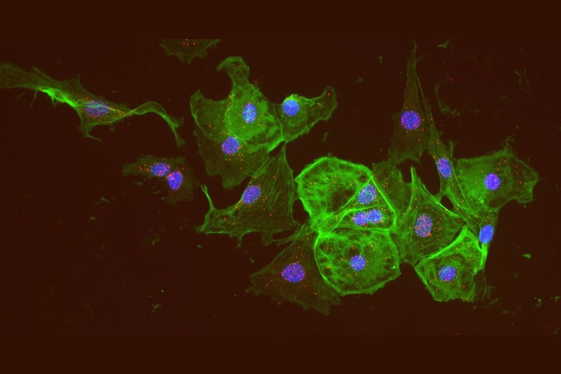 How much do you know about Duolink®?