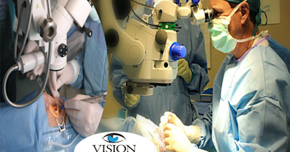 Myopia Surgery in Delhi