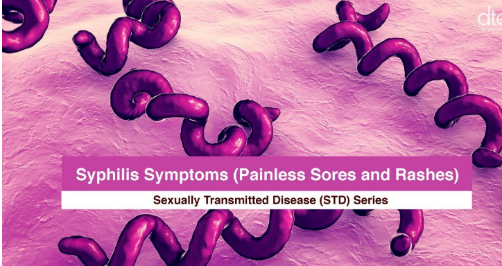 Syphilis Treatment
